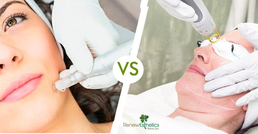 Laser Facial or Microoneedling | 2 awesome treatments